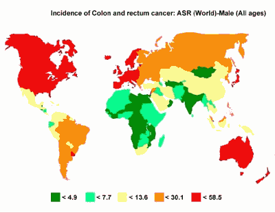 Symptoms of advanced colon cancer – Metastatic Liver Cancer